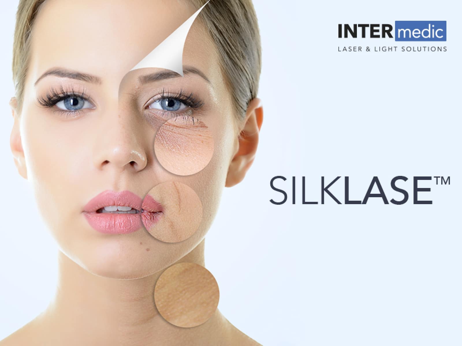 Lucir una piel más joven es cuestión de minutos, láser de CO2 Silklase ...